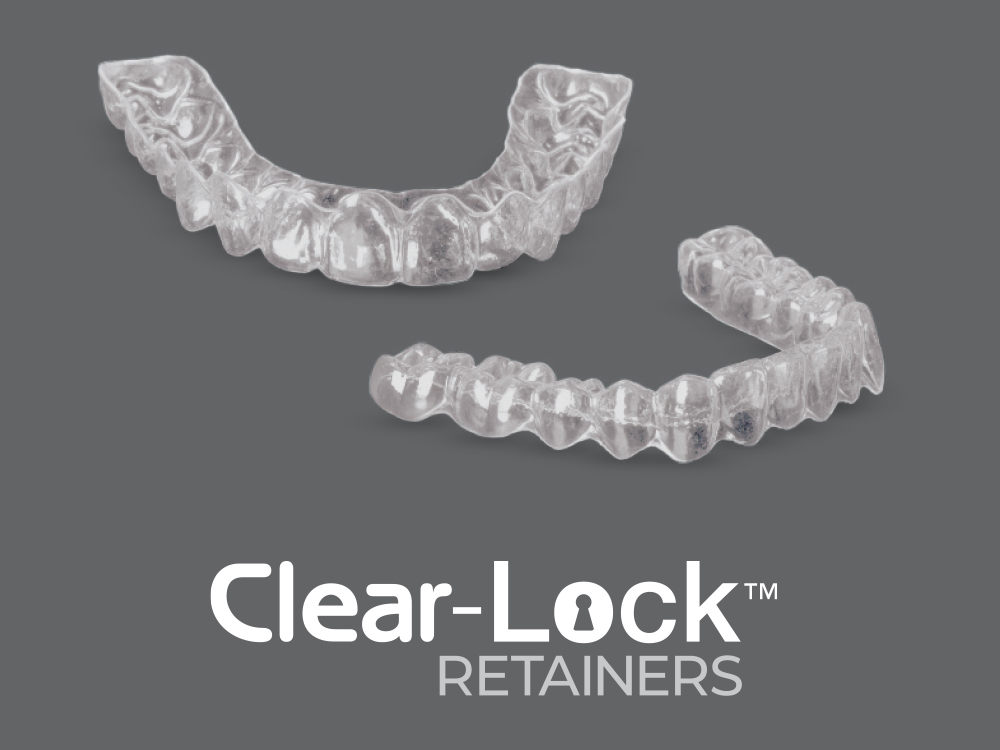 Types Of Clear Retainers