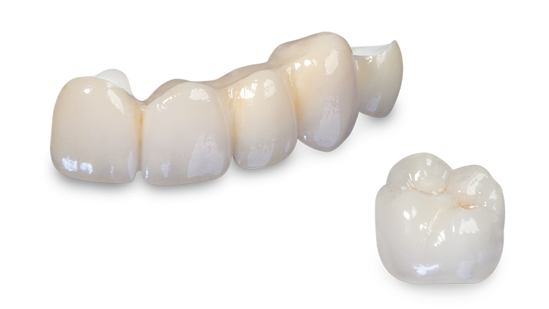 Best Dental Crown and Bridge Dental Lab - Glidewell Dental