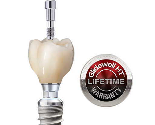 Glidewell HT™ Implants - Dental Implants - Glidewell Dental