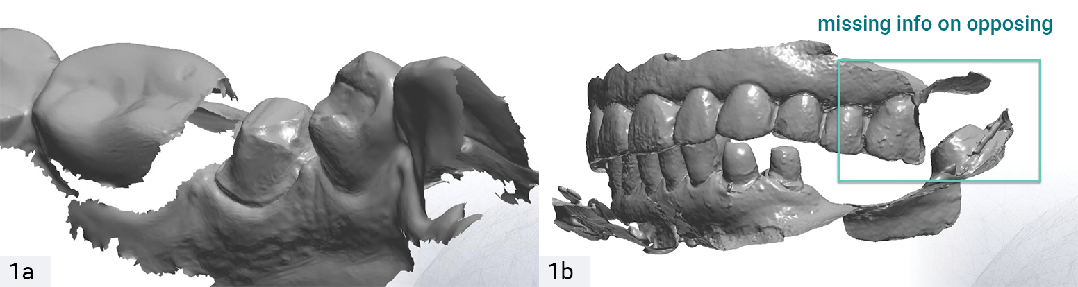 3 Mistakes You Don't Want to Make with Digital Impressions | Glidewell