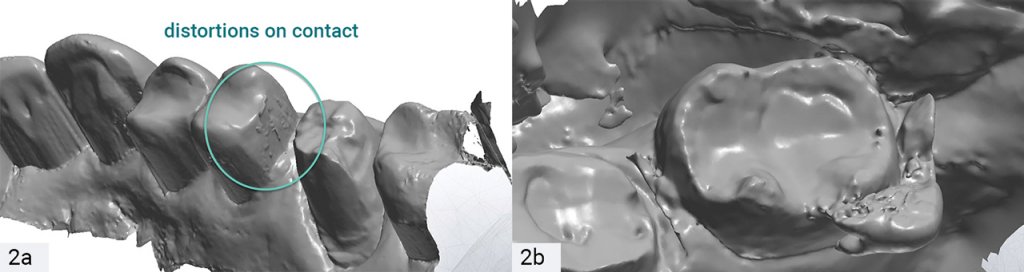 3 Mistakes You Don't Want to Make with Digital Impressions | Glidewell