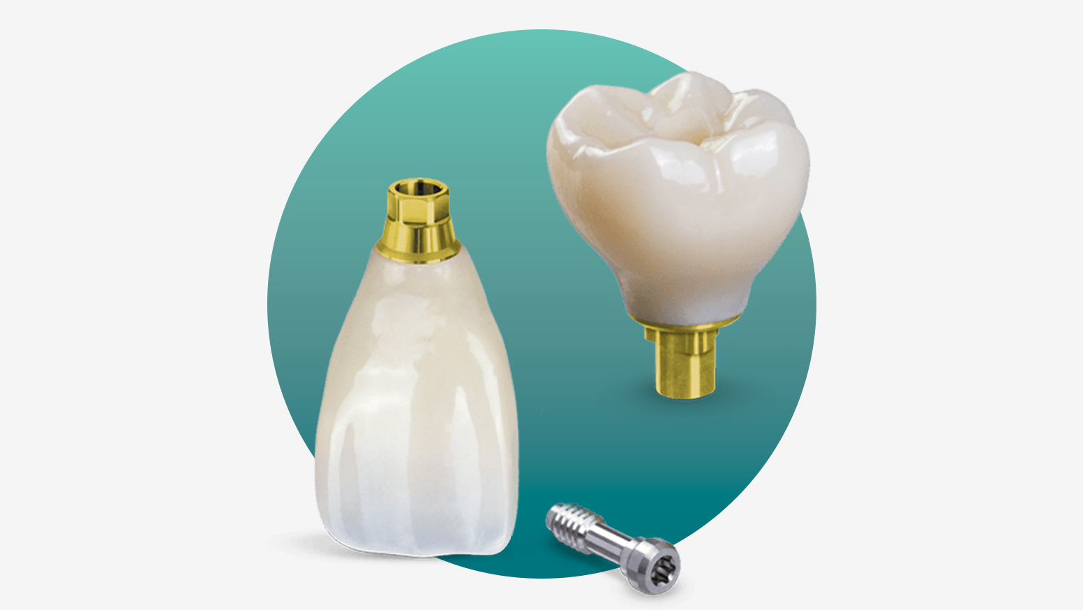 4 Key Questions About Screw-Retained Crowns | Glidewell