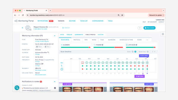 5 Ways Clear Aligners Can Transform Your Practice Growth