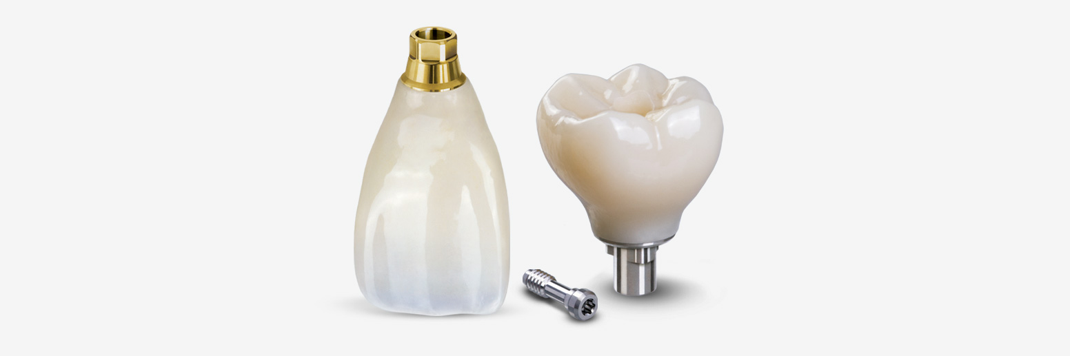 Custom Abutments vs. Screw-Retained Implant Crowns | Glidewell