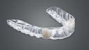 Essix Retainers vs. Flippers: A Clinical Comparison