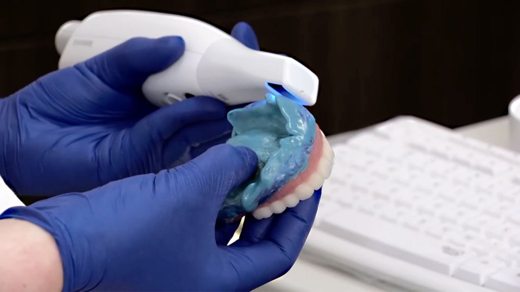 How Digital Denture Workflows Are Changing Dentistry