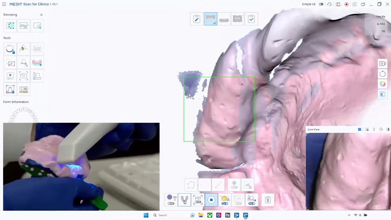 How Digital Denture Workflows Are Changing Dentistry