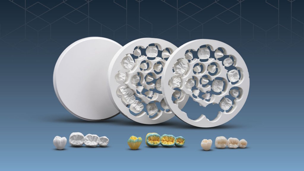 BruxZir® Zirconia: Recession Buster for Your Practice