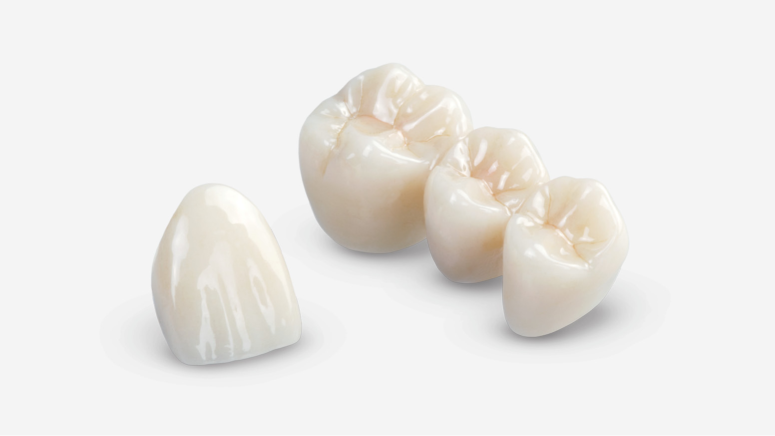 Choosing Between Zirconia Crowns and PFM Crowns | Glidewell