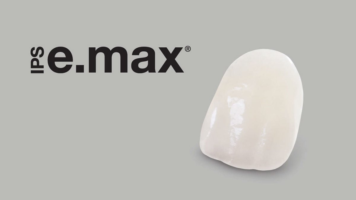 How to Choose Between Zirconia Crowns and IPS e.max® Crowns | Glidewell