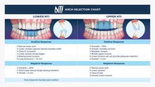 How to Choose the Right Arch for an NTI-tss Plus® Appliance