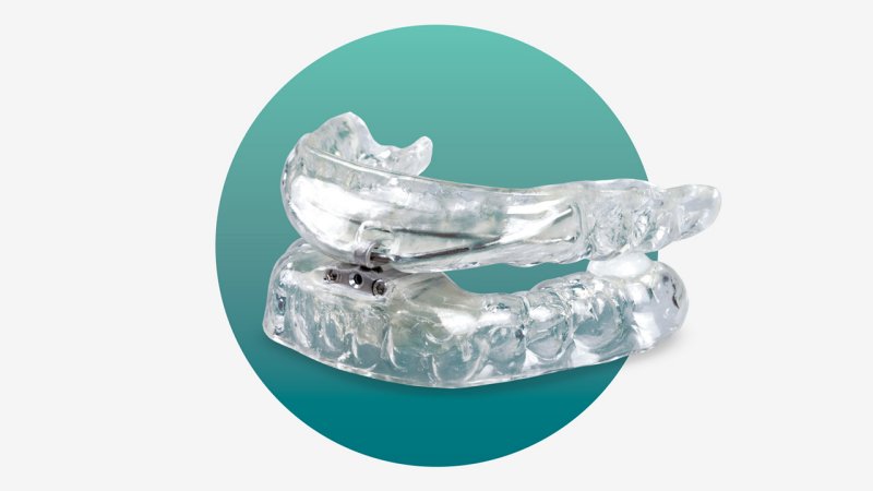 How to Discuss Sleep Apnea Treatment with Patients | Glidewell