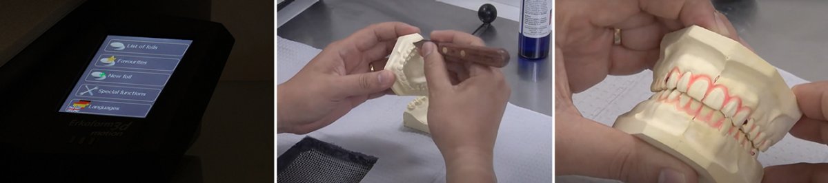 How to Make an EMA® Appliance In-Office | Glidewell