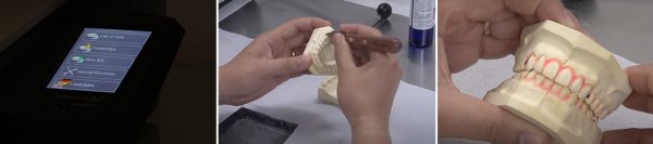 How to Make an EMA® Appliance In-Office | Glidewell