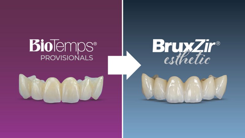 How to Use Temporary Dental Crowns to Boost Treatment Results