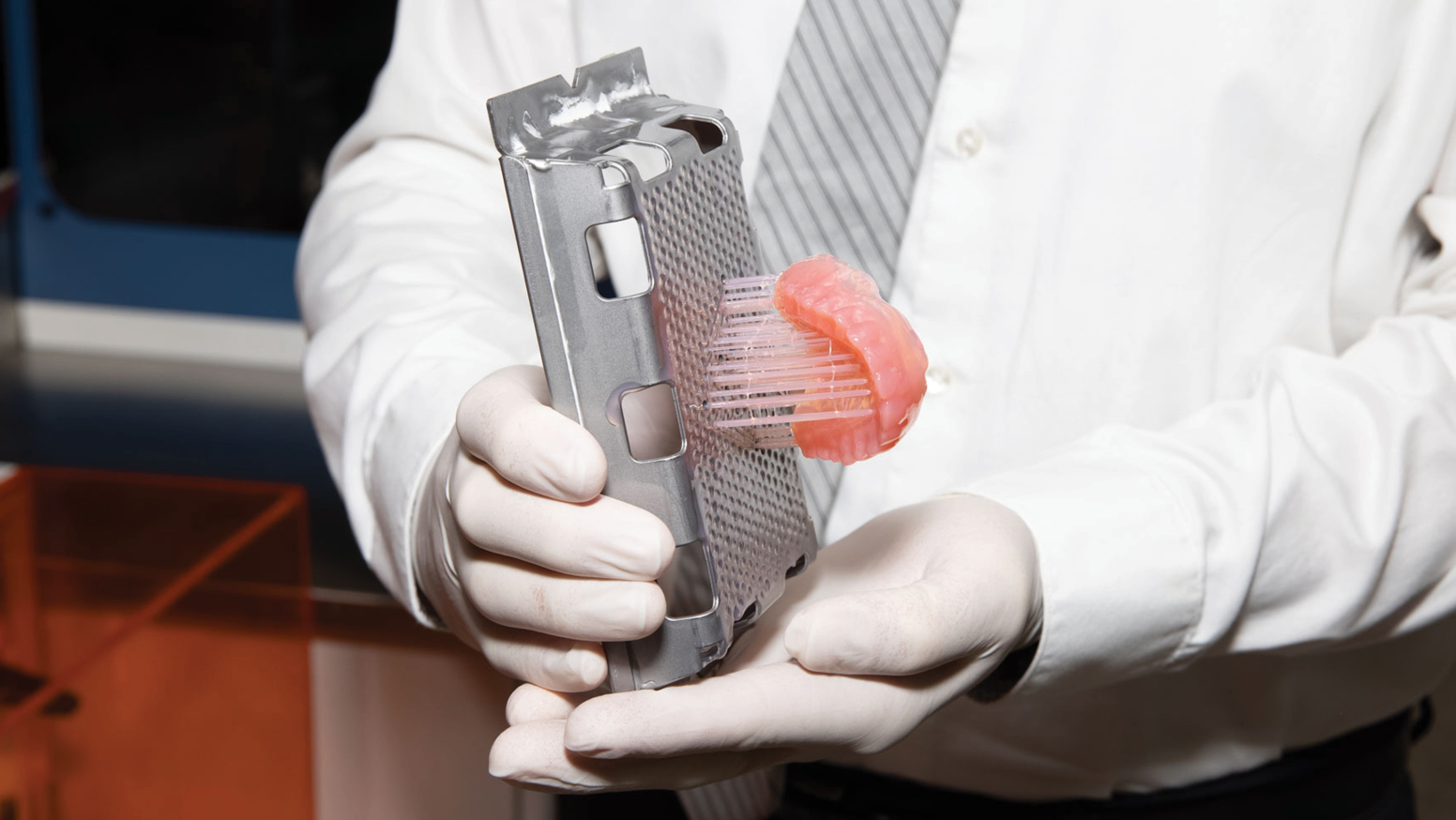 3D-Printed Immediate Dentures: Advantages Explained