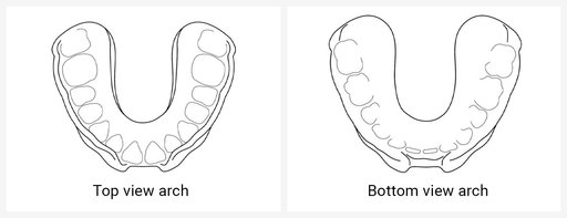 AM Aligner Corrects Temporary Morning Bite Change | Glidewell