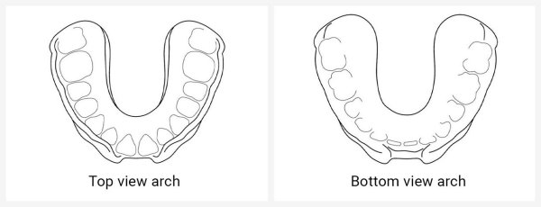 AM Aligner Corrects Temporary Morning Bite Change | Glidewell