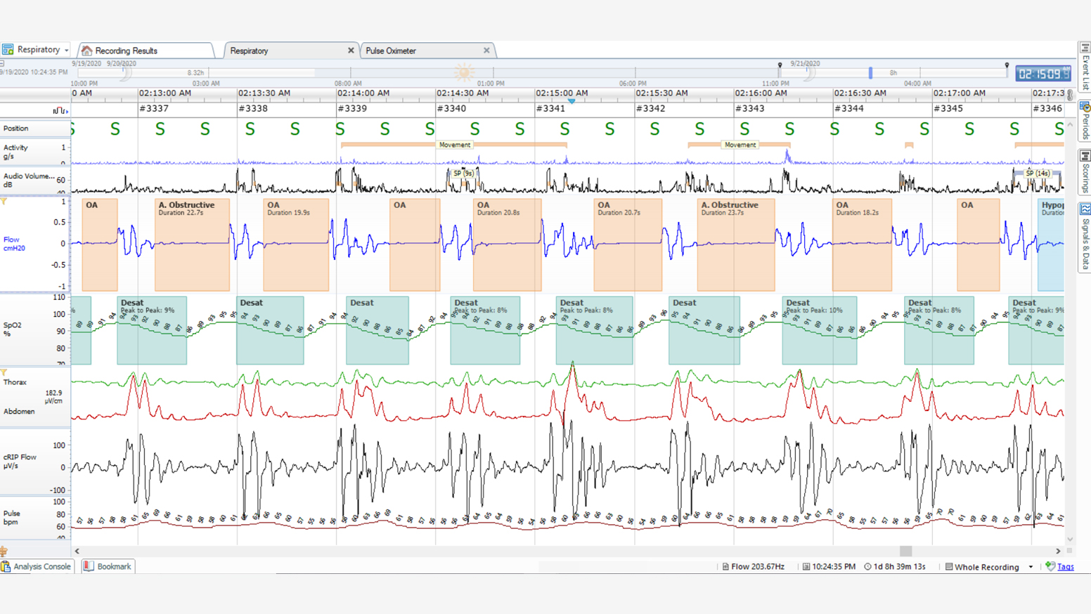 What Is Obstructive Sleep Apnea? | Glidewell