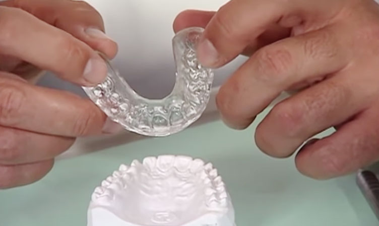 Preventive Solutions