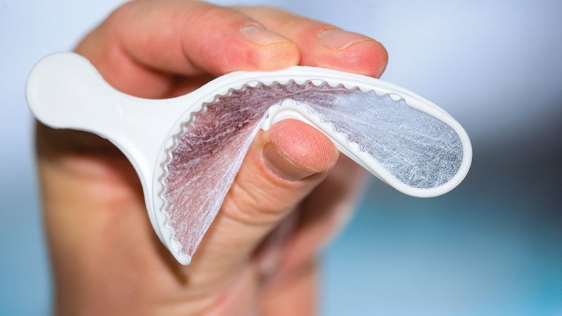 Bite Registration 101