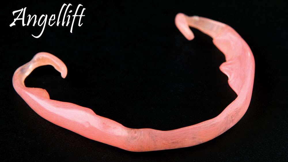 Noninvasive “Face-lift” for your Dentate Patients: A New Device and ...