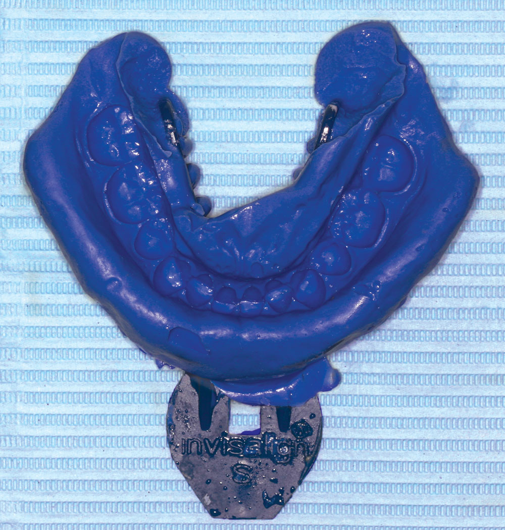 Noninvasive “Face-lift” for your Dentate Patients: A New Device and ...