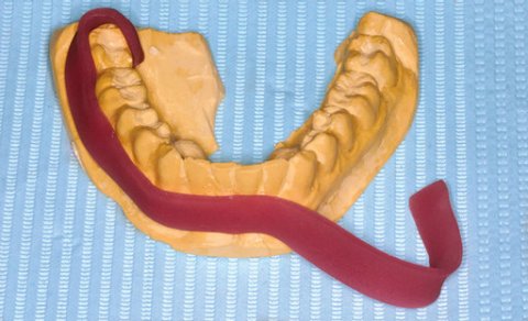 Noninvasive “Face-lift” for your Dentate Patients: A New Device and ...
