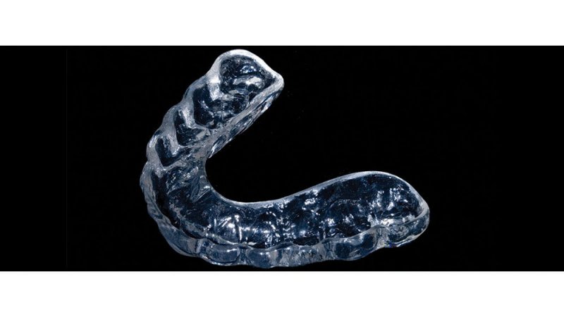 Clinician Spotlight: Occlusal Splints