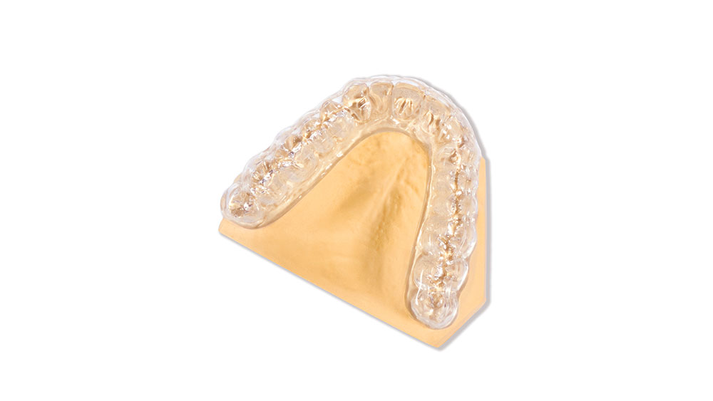 Clinician Spotlight: Occlusal Splints