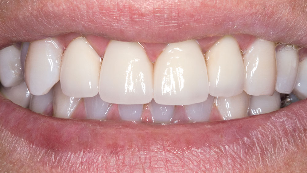 Prismatik CZ Photo Gallery