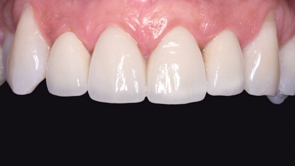 Prismatik CZ Photo Gallery