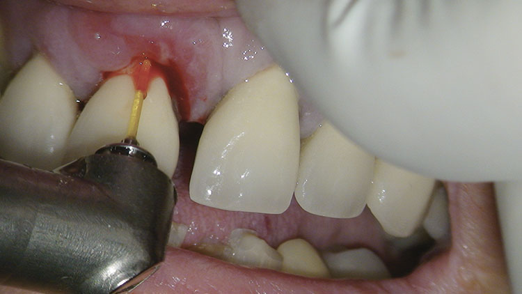 Buffered Anesthetics and Laser Use: Efficiency in Scheduling and ...