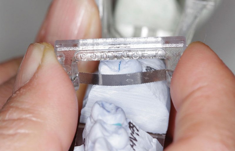 Simplifying Accurate Evaluation: Adjustment of Proximal Contacts