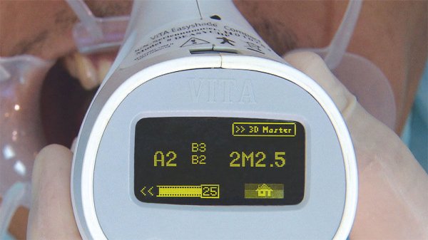 Photo Essay: Ensuring Adequate Reduction with the Reverse Preparation ...