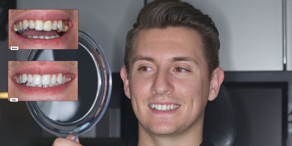 Photo Essay – Central Details: Renewing a Smile with an Esthetic ...