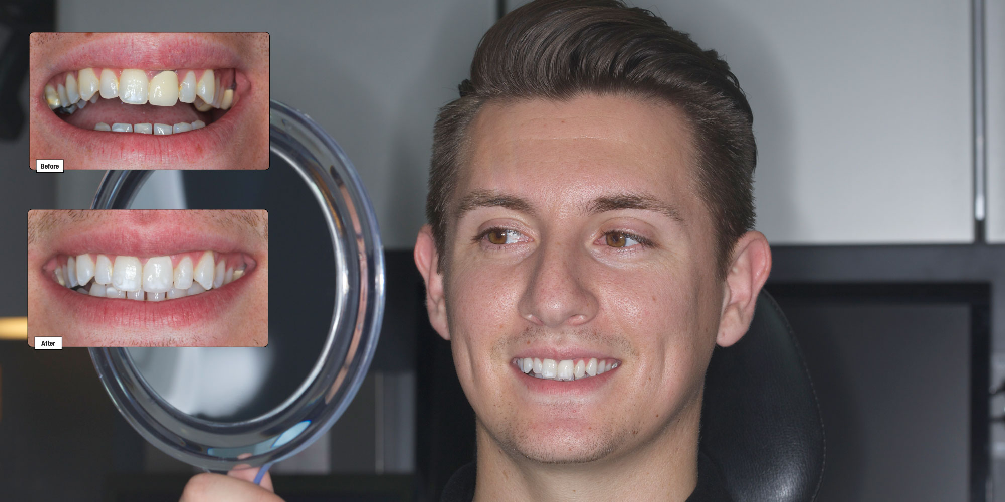 Photo Essay – Central Details: Renewing a Smile with an Esthetic ...