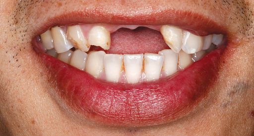 Photo Essay: Treatment Planning After Facial Trauma
