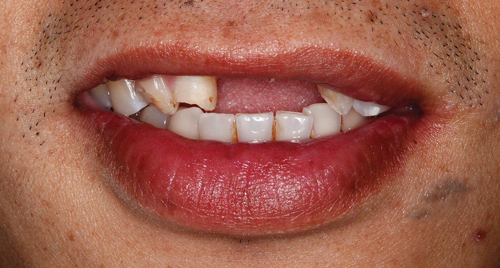 Photo Essay: Treatment Planning After Facial Trauma