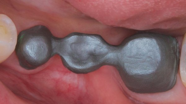 Product Spotlight: Obsidian® Pressed to Metal