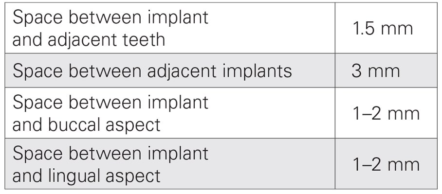 Implant Spacing and Selection in the Posterior