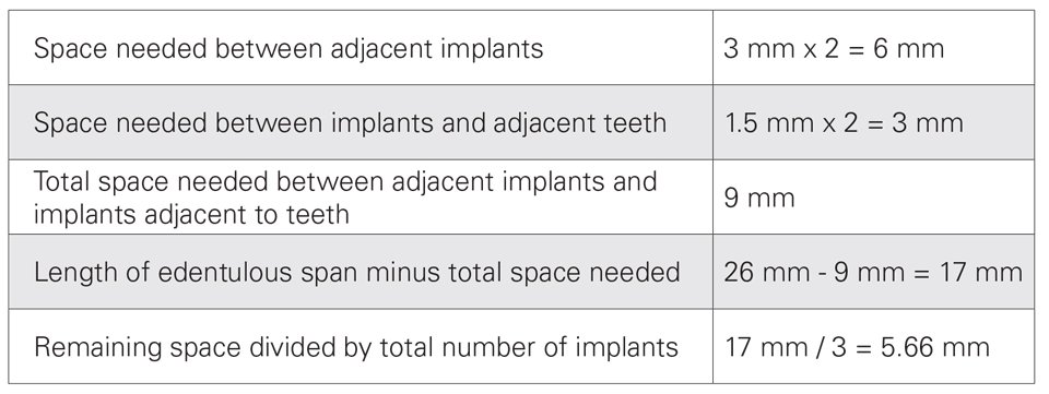 Implant Spacing and Selection in the Posterior