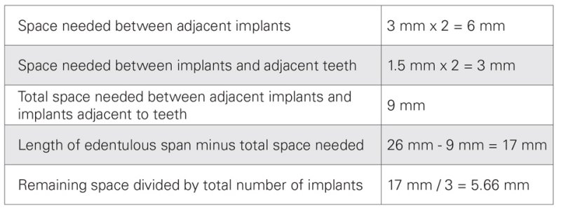 Implant Spacing and Selection in the Posterior