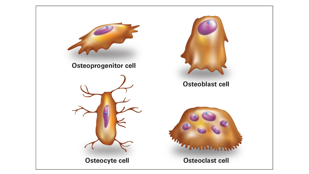 Bone Substitutes in Oral Implantology