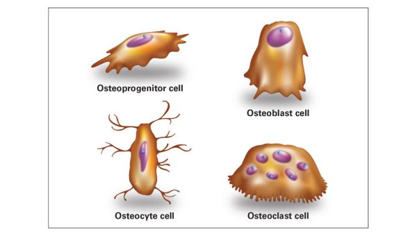 Bone Substitutes in Oral Implantology