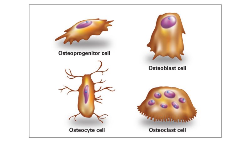 Bone Substitutes in Oral Implantology