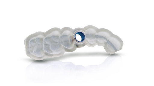 Clinical Benefits of Digitally Guided Implant Surgery