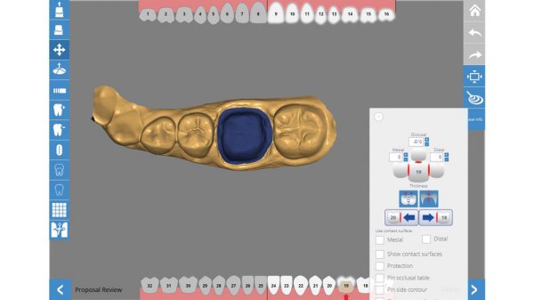 Improving the Quality of Dental Restorations with Artificial ...