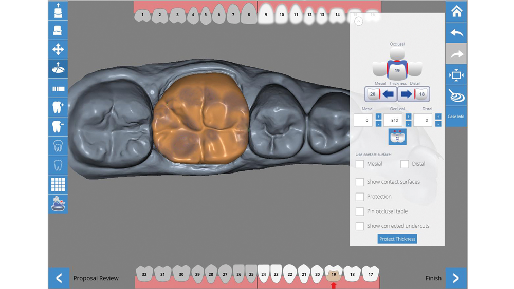 Improving the Quality of Dental Restorations with Artificial ...