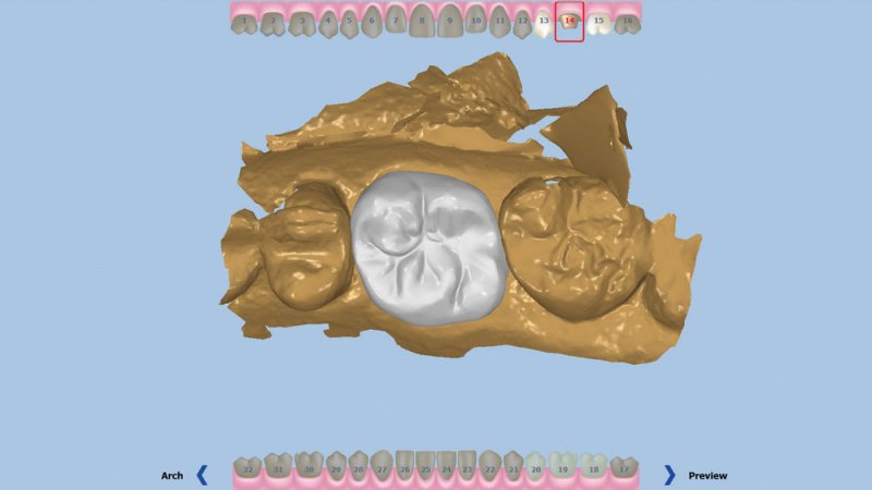 Improving the Quality of Dental Restorations with Artificial ...